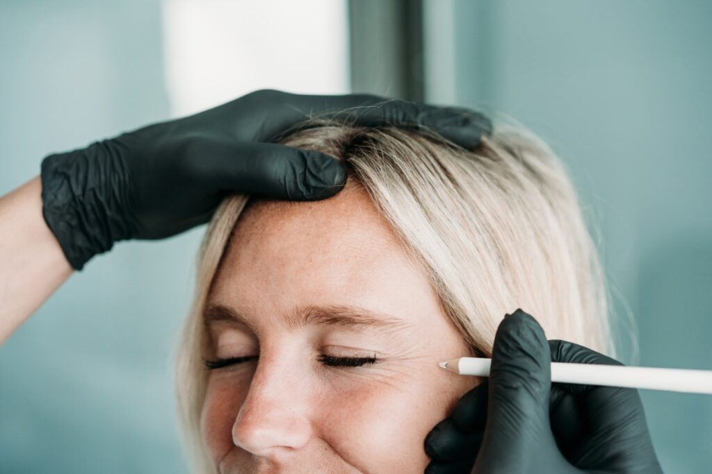 Crows Feet - Livara Aesthetics